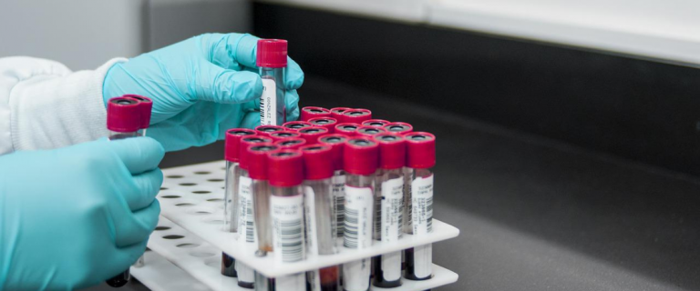 LIMS vs ELN: What Are The Differences and How To Choose